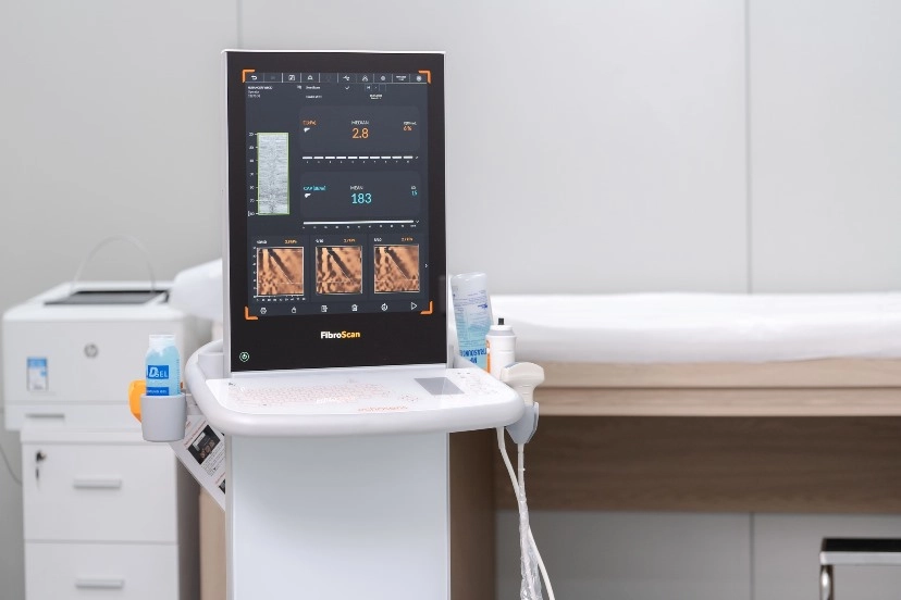 Fibroscan