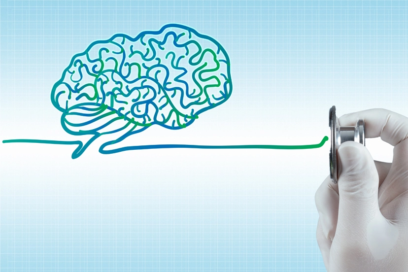 Aneurysm Coiling for Stroke Treatment