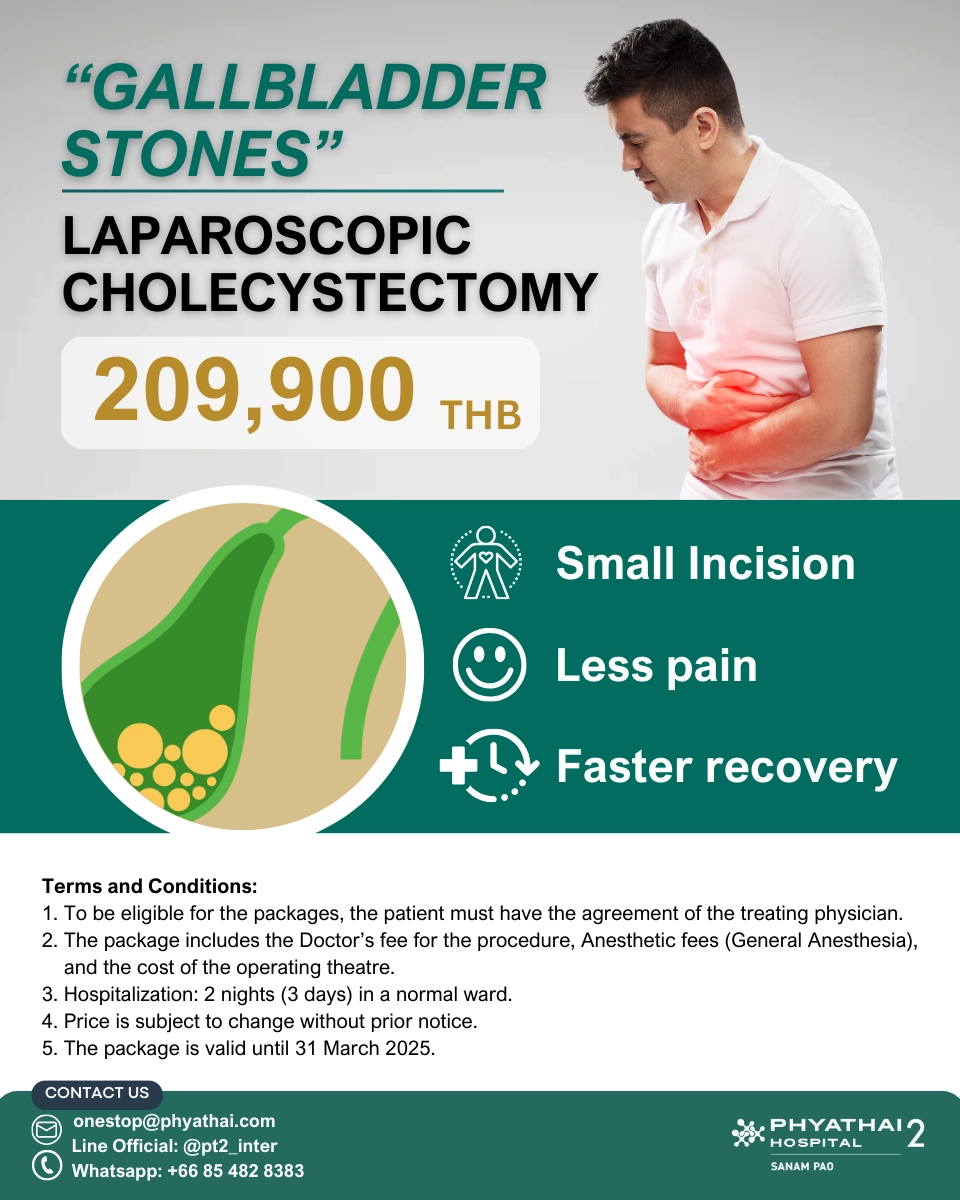 Laparoscopic Cholecystectomy
